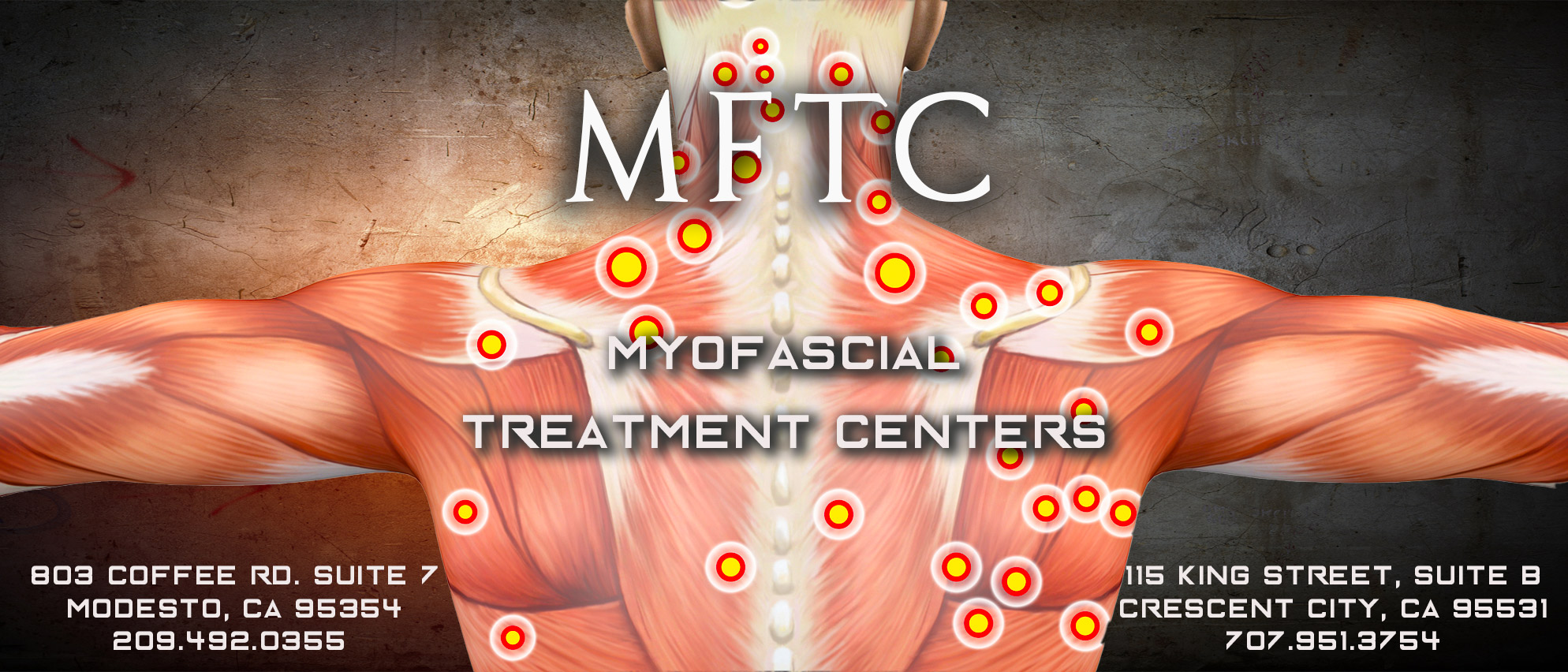 What Is Fascia? | MFR Education Pain Relief